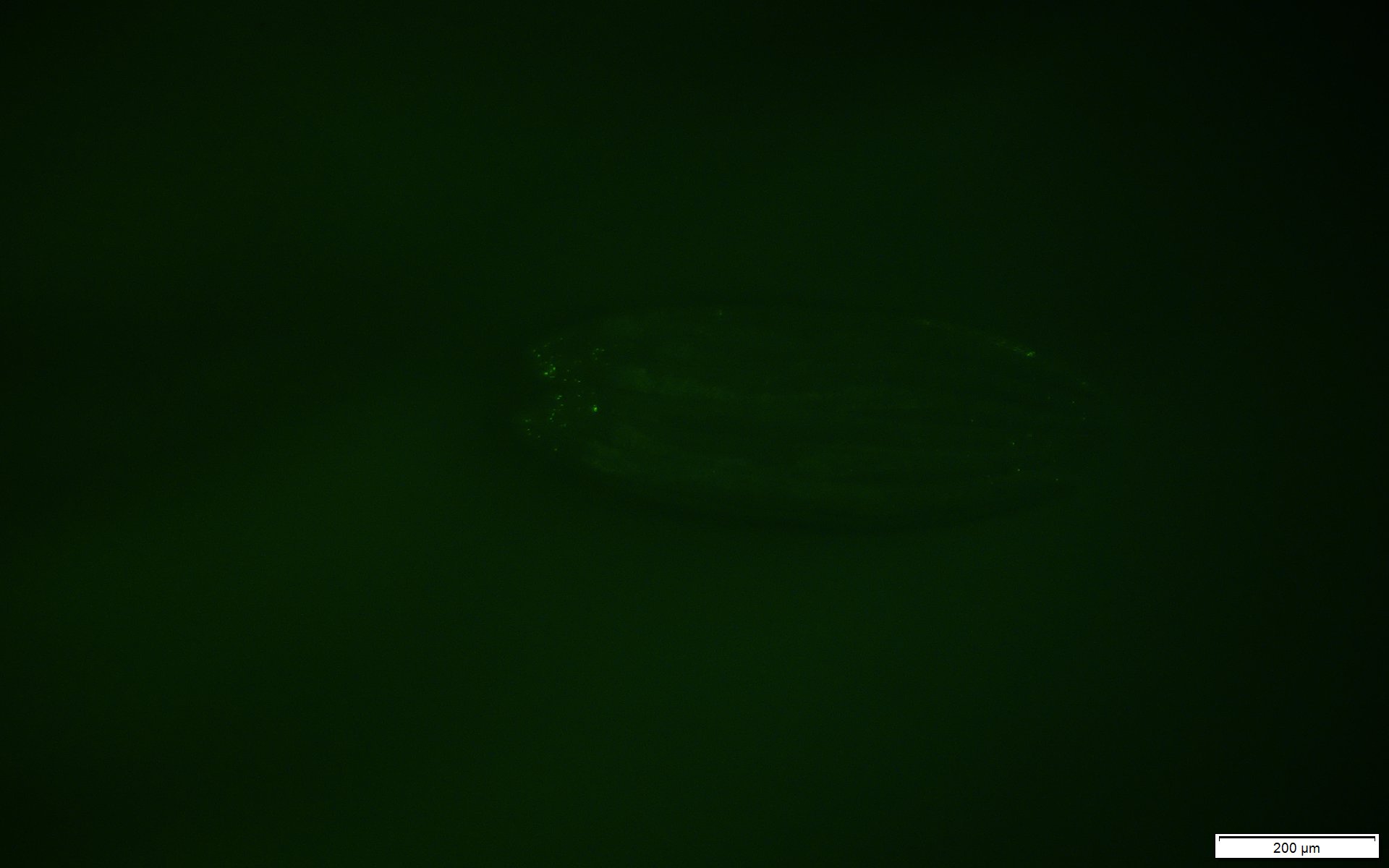 RNAi Screens of EAK103 in C. Elegans – Mytochondria